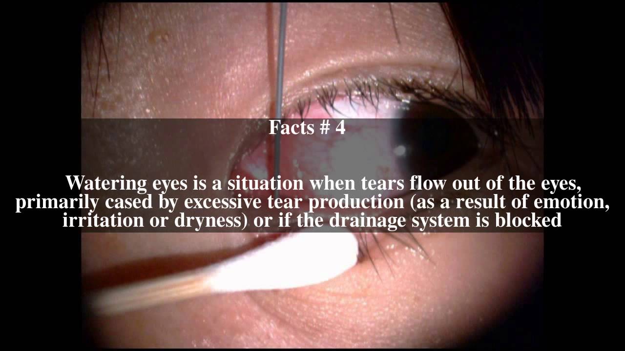 Punctoplasty Top # 5 Facts - YouTube