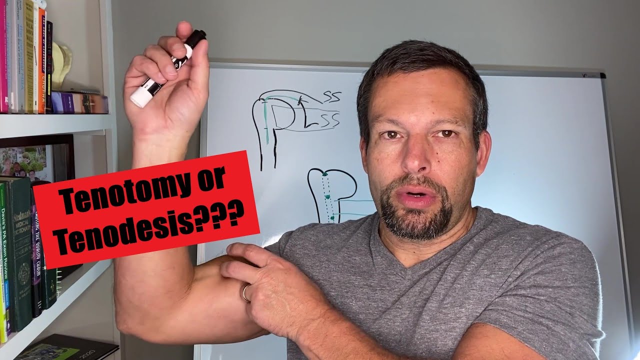 Biceps Tenodesis vs Tenotomy: How & Why We Treat the Biceps in Shoulder ...