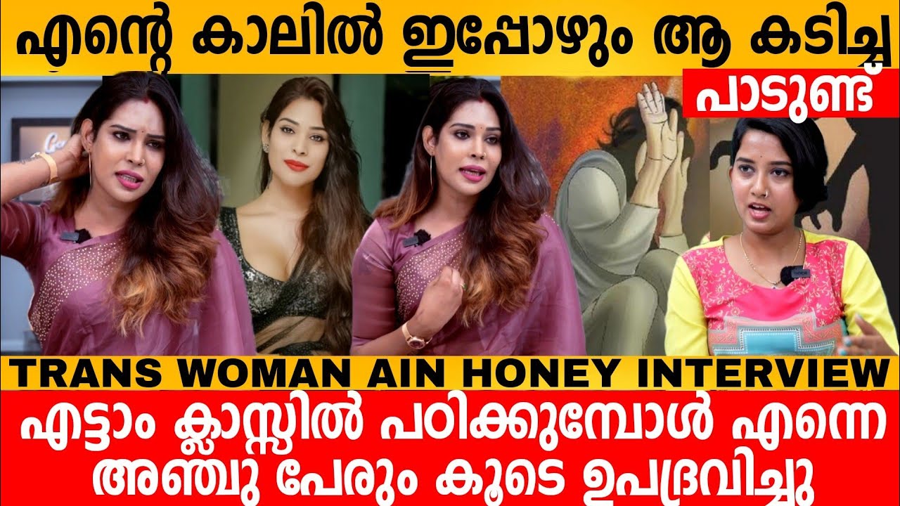 എന്റെ കാലിൽ ഇപ്പോഴും ആ കടിച്ച പാടുണ്ട്. TRANS WOMAN AIN HONEY AAROHI ...