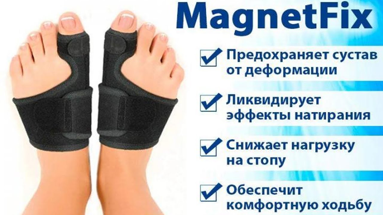 ЛАНГЕТА НА ПАЛЕЦ НОГИ ⚠ ШИНА НА БОЛЬШОЙ ПАЛЕЦ НОГИ КУПИТЬ Youtube