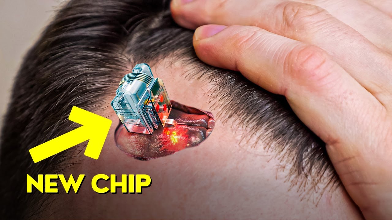 Elon Musk's TERRIFYING Brain Chip Is Turning Into Reality - YouTube