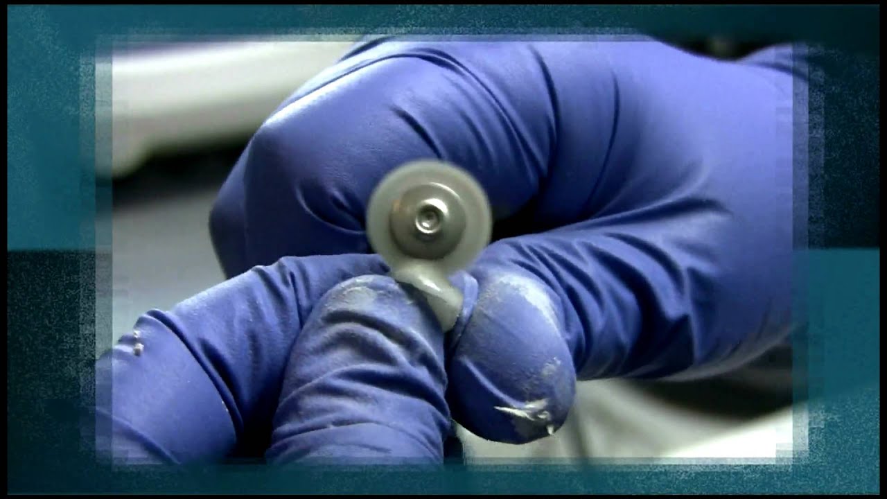 Amazing Pain-Free Dentist Dr. Simon Rosenberg Uses CEREC® 3D - YouTube