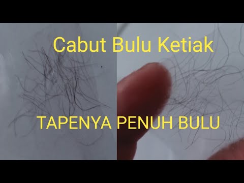 Cabut Bulu Ketiak Pake TAPE - YouTube