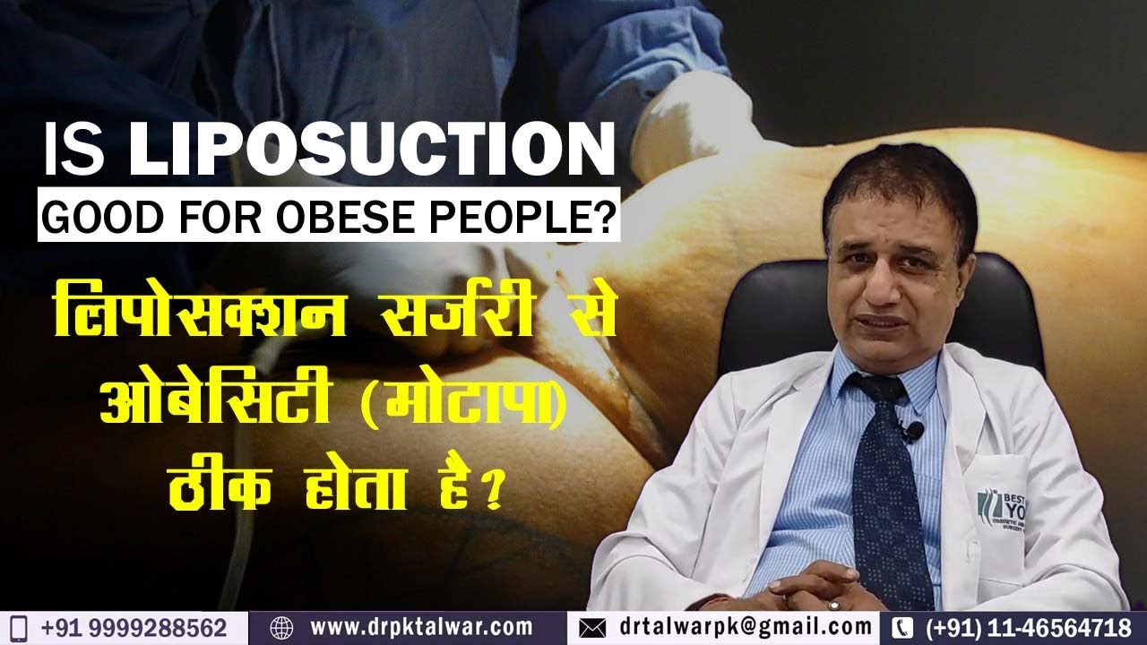 Liposuction Surgery for Obesity? Is Liposuction Good for Obese People ...