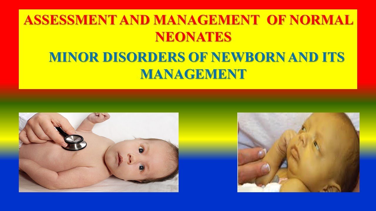 ASSESSMENT AND MANAGEMENT OF NEW BORN BABY - definition , disorders ...