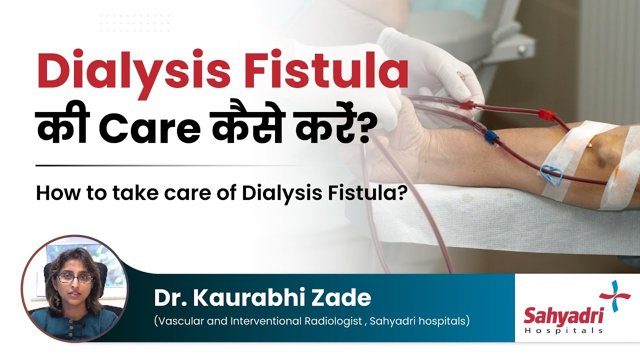 Dialysis fistula की Care कैसे करें? | How to take care of Dialysis ...