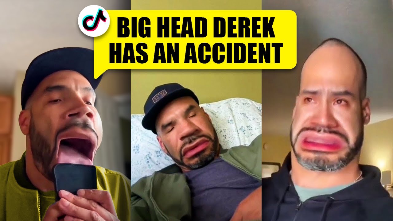 Big Head Derek has an Accident | Jason Banks Comedy - YouTube