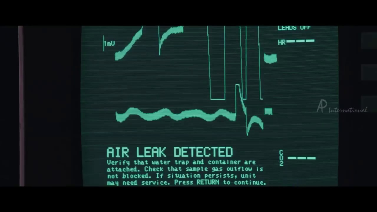 Miya George gets shock treatment (ECT scene) - YouTube