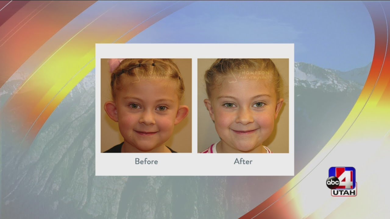 Utah Facial Plastics - YouTube