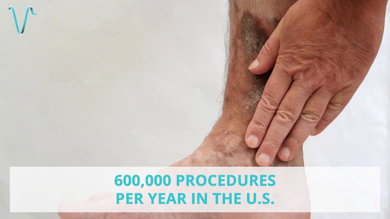 InVera Medical - Overview - YouTube