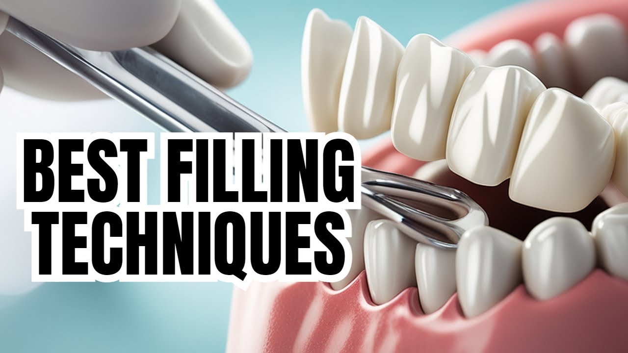 Expert Insights: The Best Composite Tooth Filling Technique #teeth # ...