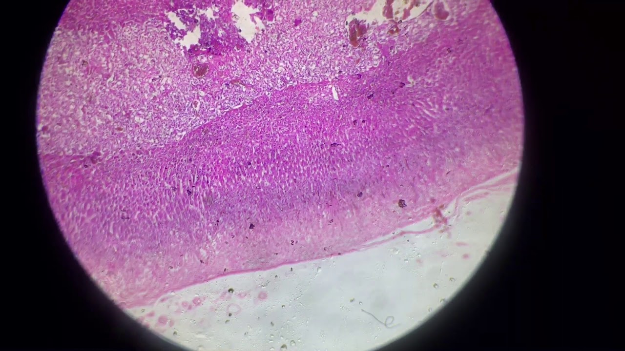 Lamina De Histología Glándula Suprarrenal 33 Youtube