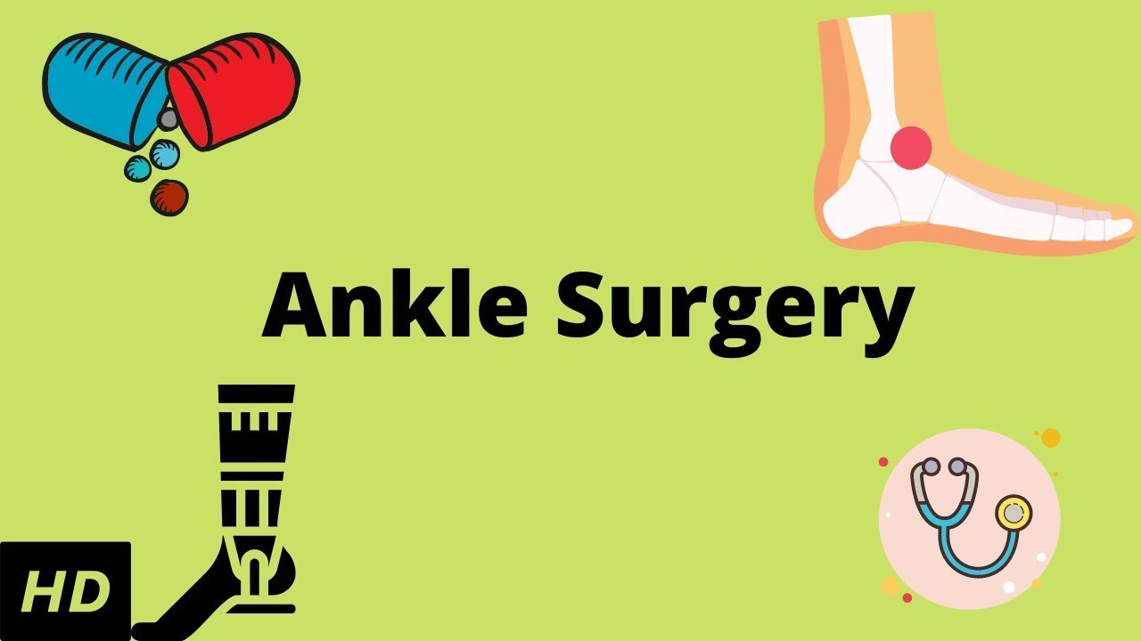 Ankle Surgery: Everything You Need to Know - YouTube