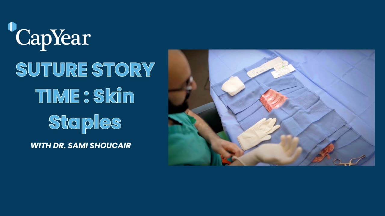 Medical History Pt. 3 Skin staples?! - YouTube