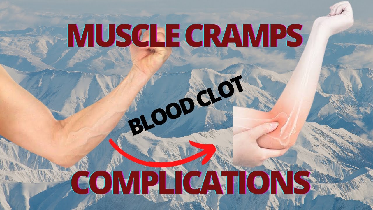 Muscle Cramps Complications: what are the complications, how to ...