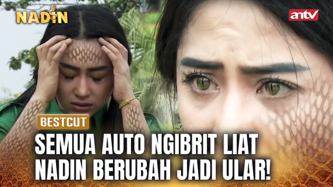 Nadin Juga Bingung Kenapa Kulitnya Bersisik!! | BestCut Nadin ANTV Eps ...