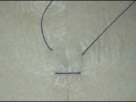 figure of eight suture - YouTube