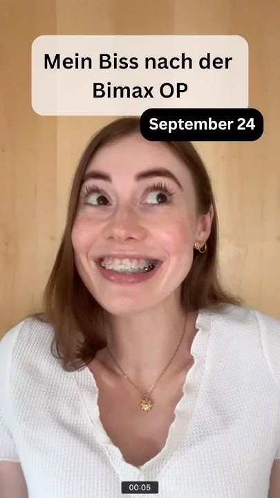 Mein Biss nach der Kiefer OP | Bimax | 5 Monate danach - YouTube
