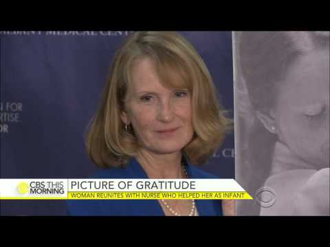 Emotional reunion for nurse and woman badly burned as infant