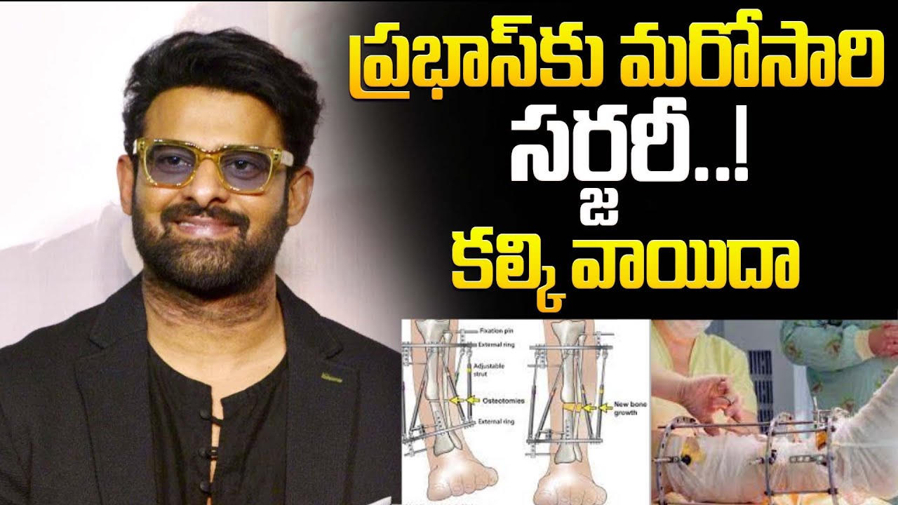 prabhas leg surgery.! || ప్రభాస్‌కు మరోసారి సర్జరీ..! || Prabhas Latest ...