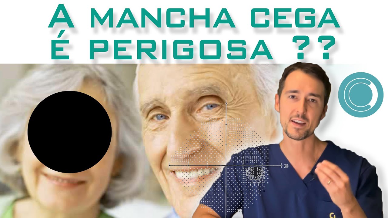 O que é a mancha cega? É perigosa?? - YouTube