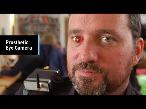 The Eyeborg: This Man Has A Prosthetic Eye Camera
