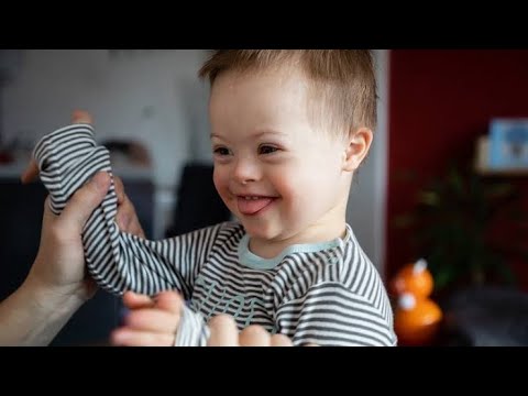 Pediatrics: Approach to a Dysmorphic Child - YouTube