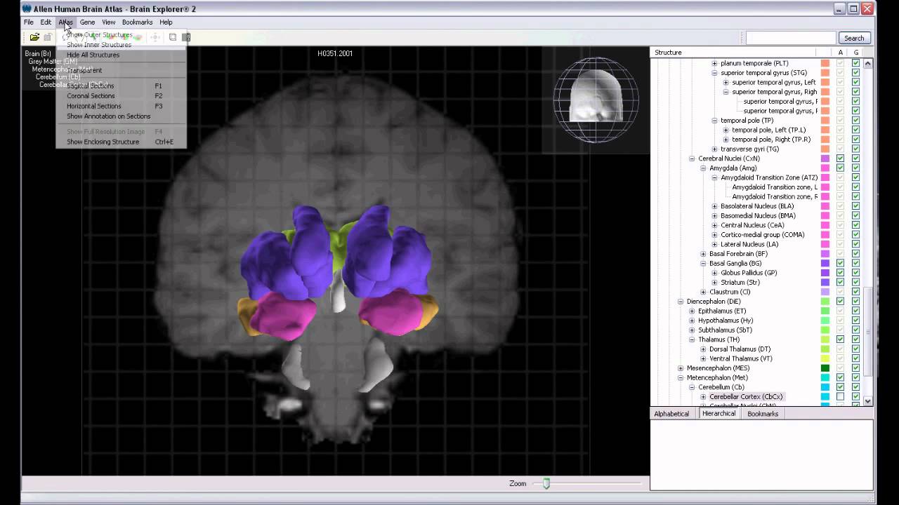 Human Brain Explorer 2 - YouTube
