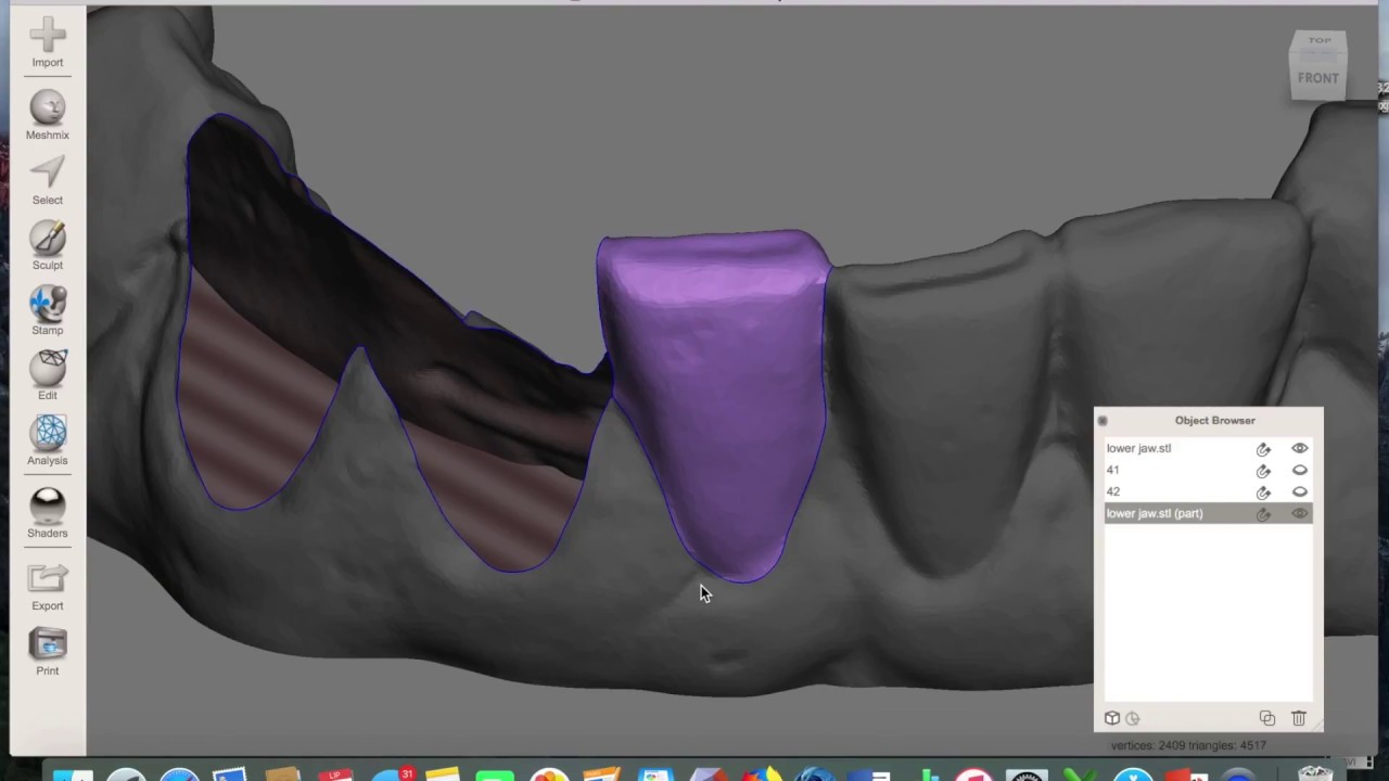 Meshmixer and aligners - YouTube