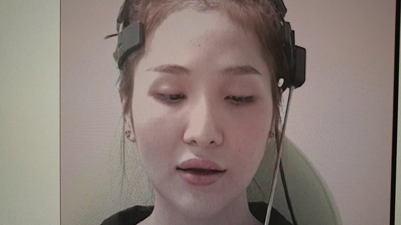 Voice change surgery before and after - YouTube