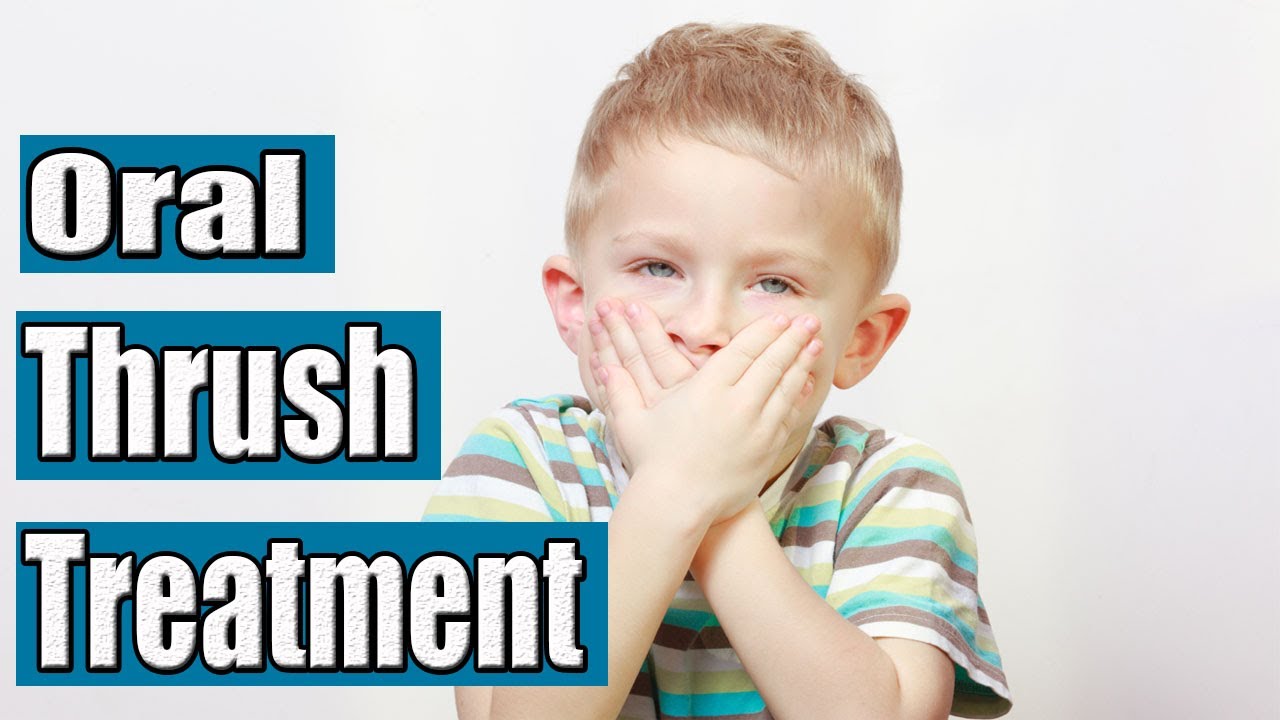 How to Treat Thrush | Oral Thrush Treatment - YouTube