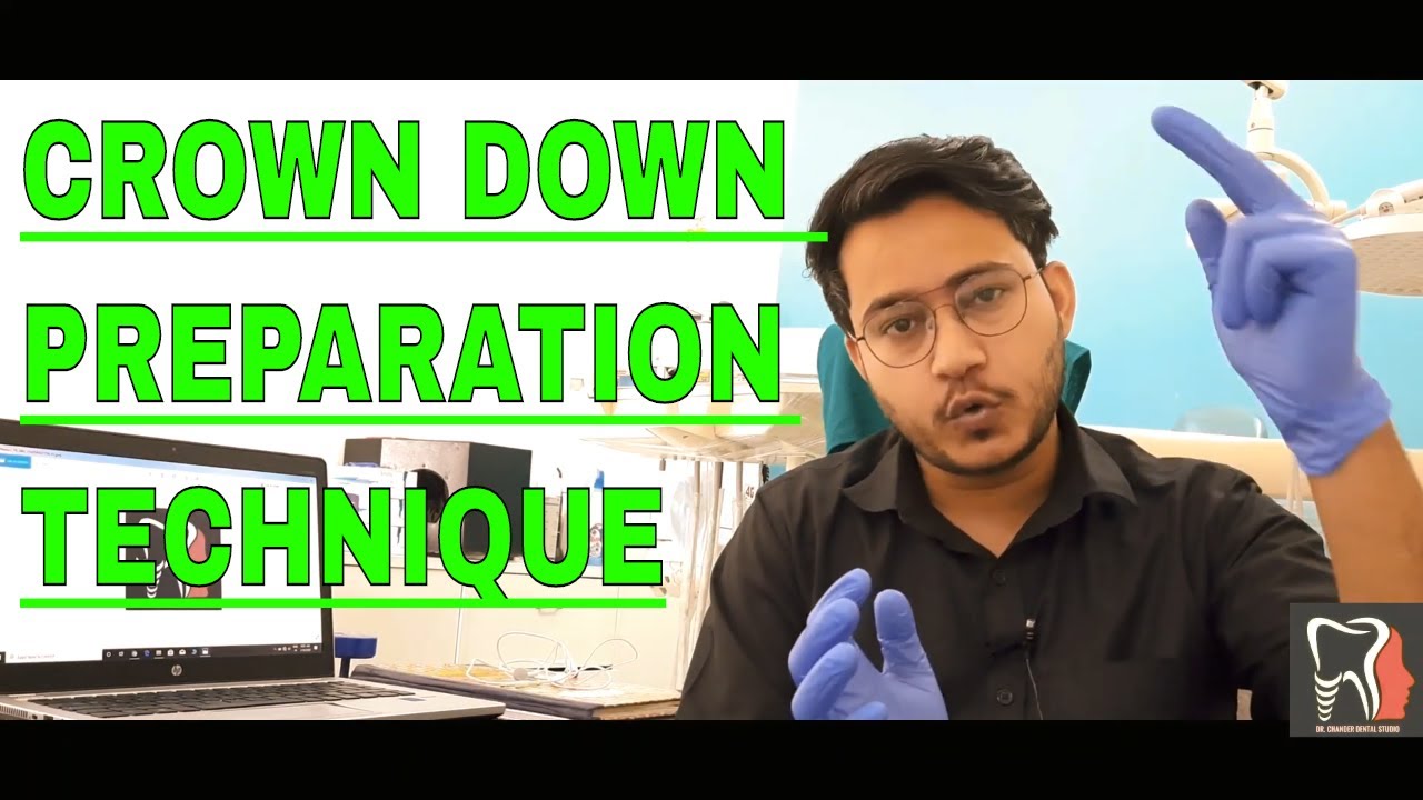 CROWN DOWN PREPARATION TECHNIQUE IN ENDODONTICS|| HINDI|| BMP|| DR ...
