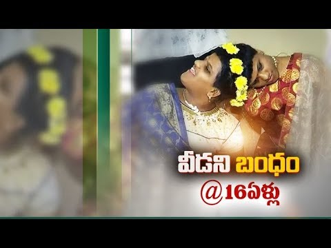 Conjoined Twins, Broken Promises | Veena & Vani Enters into 17 | at ...