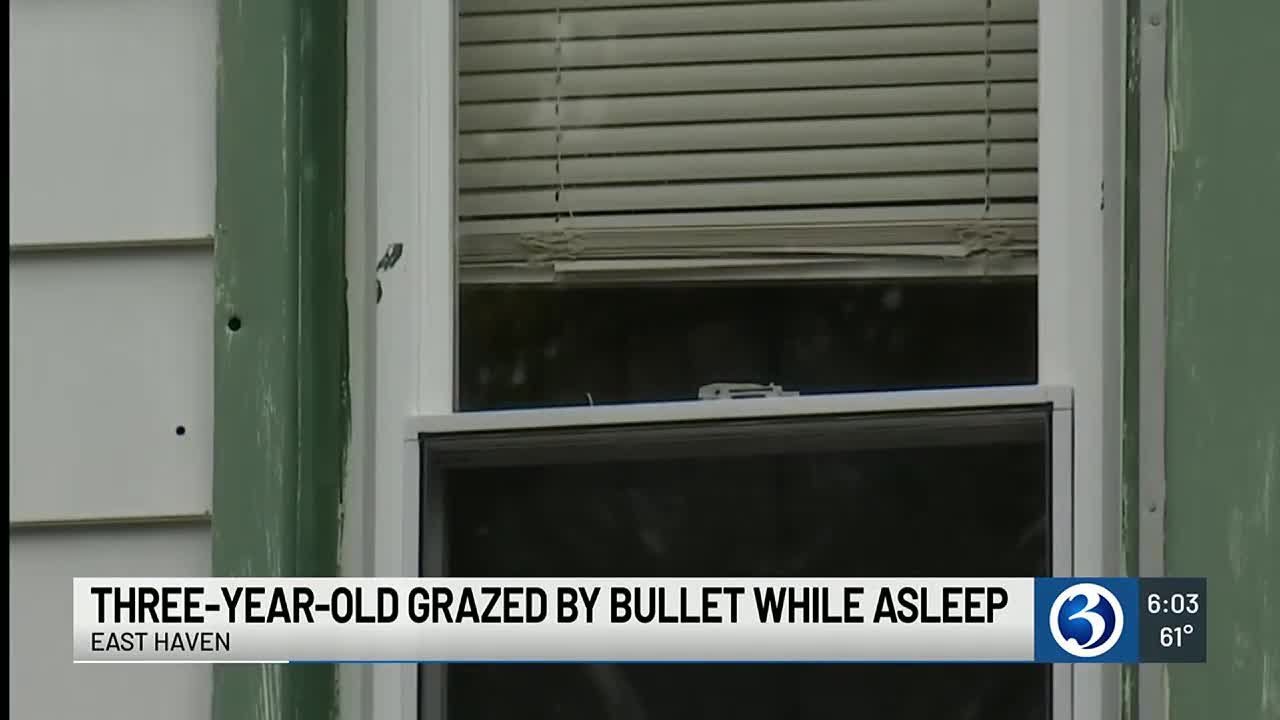 3-year-old grazed by bullet - YouTube