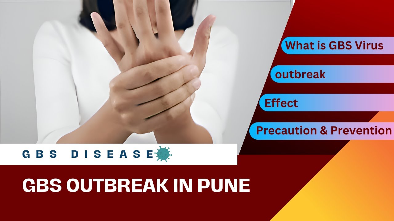 GBS outbreak in pune: What You Need to Know About Symptoms and ...