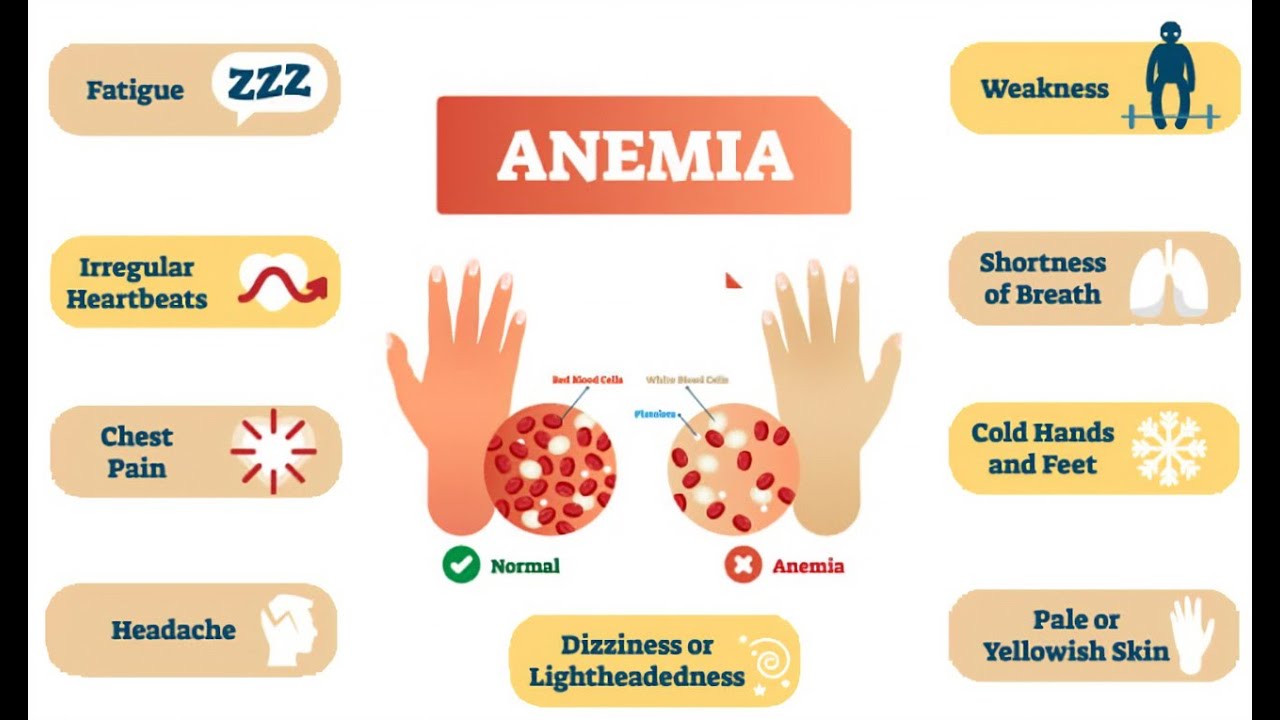 Features, Signs and symptoms of Anaemia - YouTube