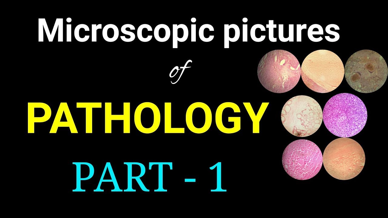 Microscopic pictures of pathology I Dr Poojireddy - YouTube