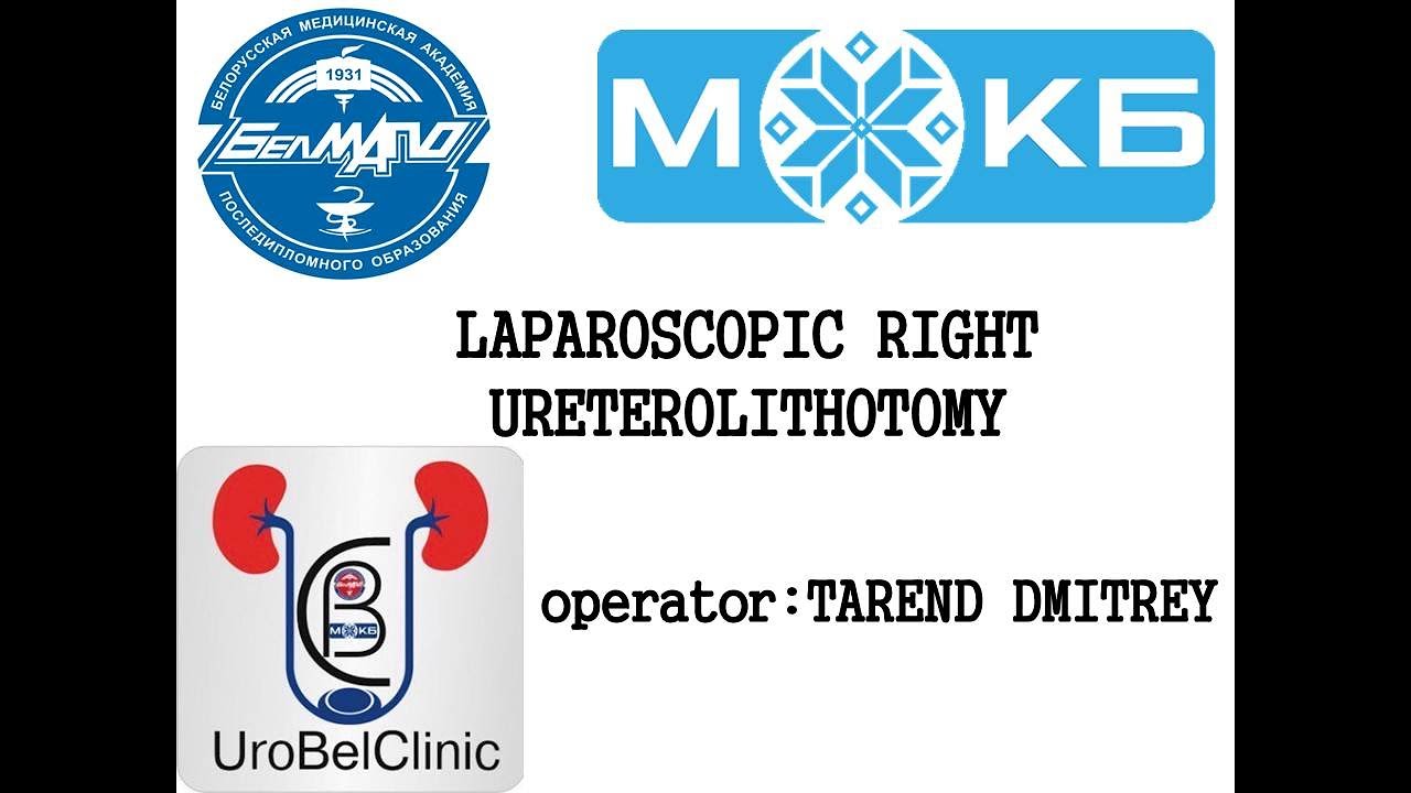 LAPAROSCOPIC URETEROLITHOTOMY - YouTube