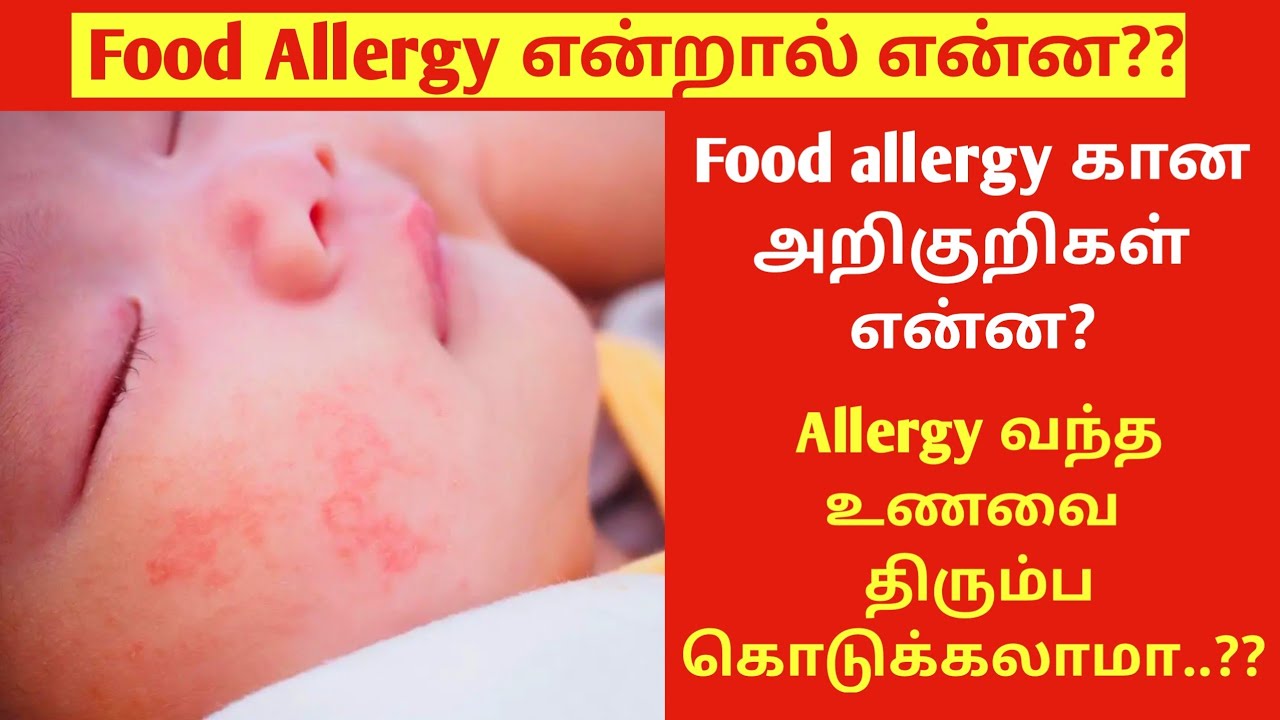 Garlic Food Allergy Symptoms at Luis Silva blog