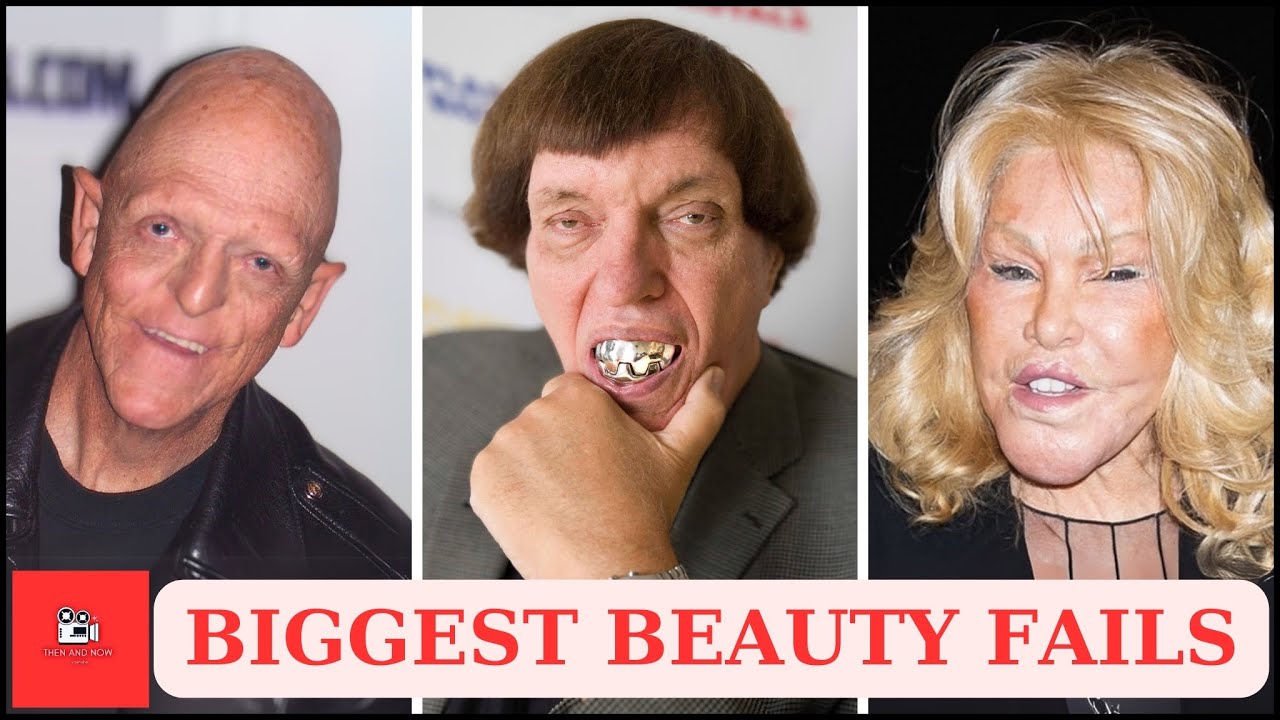 25 Hollywood's Biggest Beauty Fails | Then and now 2024 - YouTube