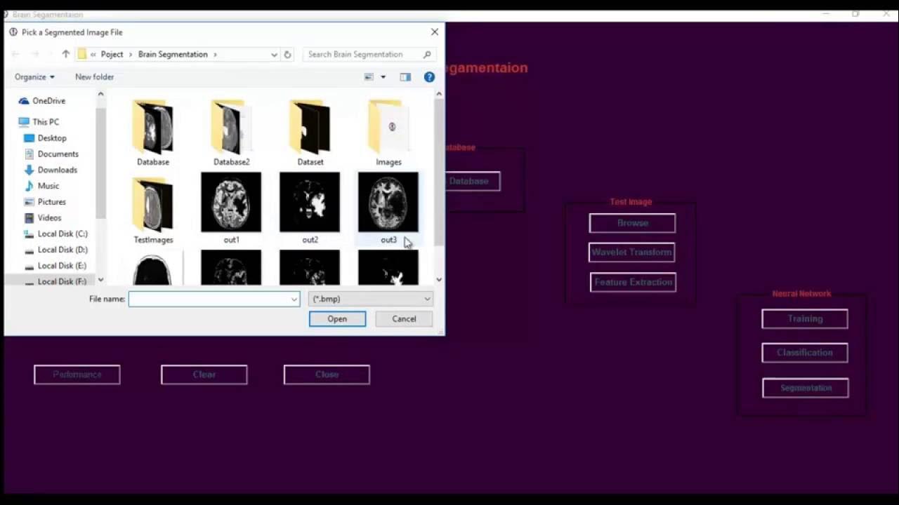 Artificial Neural Network ANN based image segmentation matlab projects - YouTube