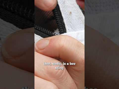 Can A Bee Sting Make Your Muscles Sore