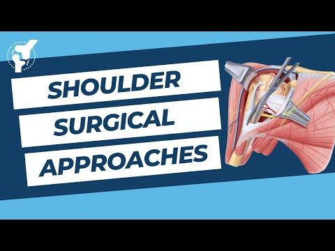 OrthoApproach - Shoulder Surgical Approaches - YouTube