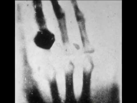 La main de Mme Röntgen - YouTube