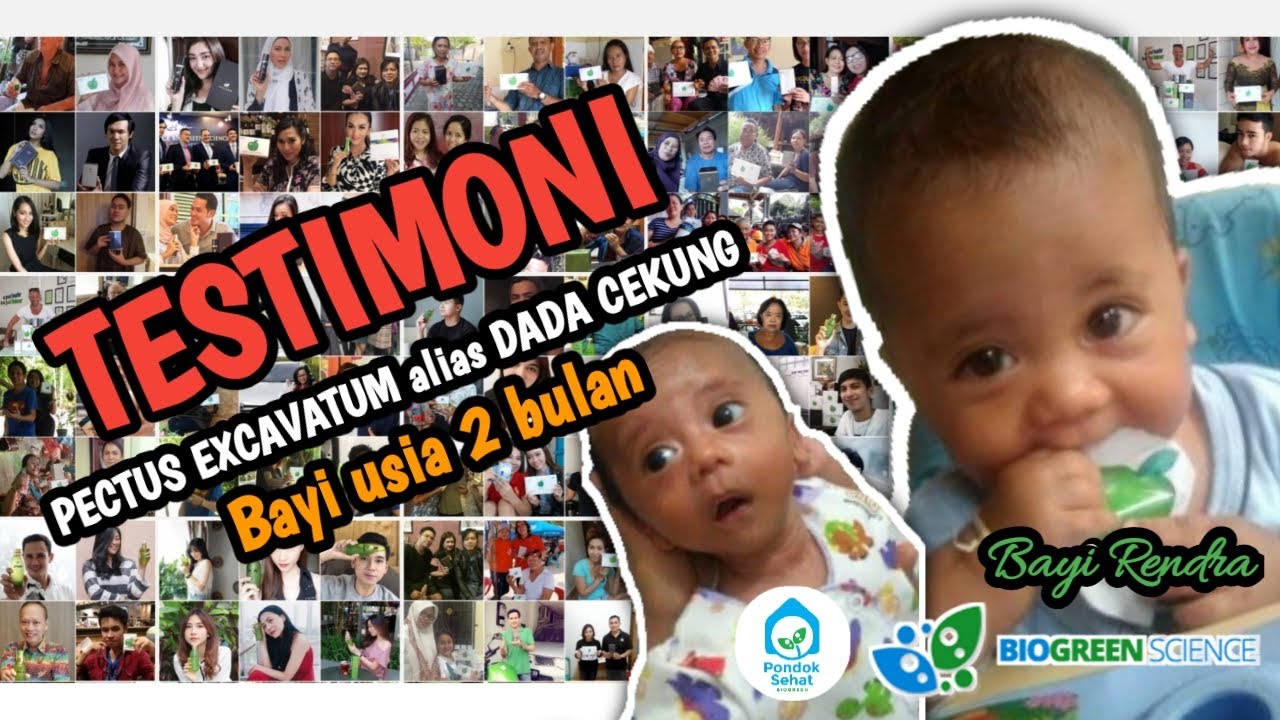 TESTIMONI - PECTUS EXCAVATUM ALIAS DADA CEKUNG - Alam Biogreen Healthy ...