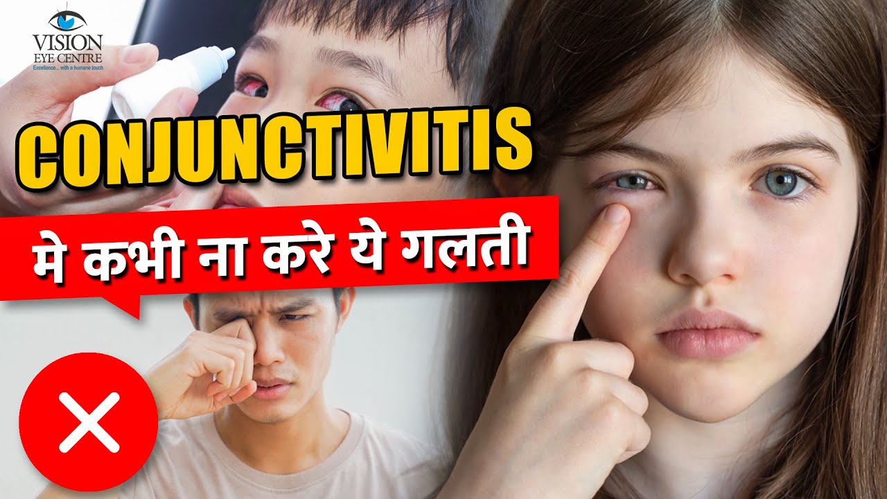 Conjunctivitis Never Do These Things In conjunctivitis-never-do-these-things-in
