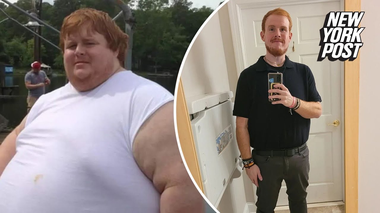 Obese Reality Star Casey King Loses 600 Lbs In Life changing Obese Reality Star Casey King Loses 600 Lbs In Life changing