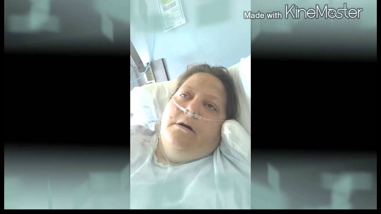 Shrinking granny, surgery Day! - YouTube