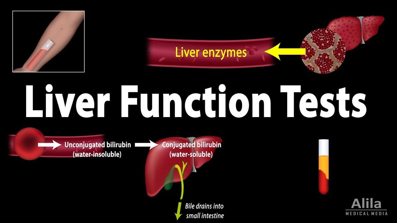 Clinical Biochemistry Liver Function Tests Lecture 1 YouTube clinical-biochemistry-liver-function-tests-lecture-1-youtube