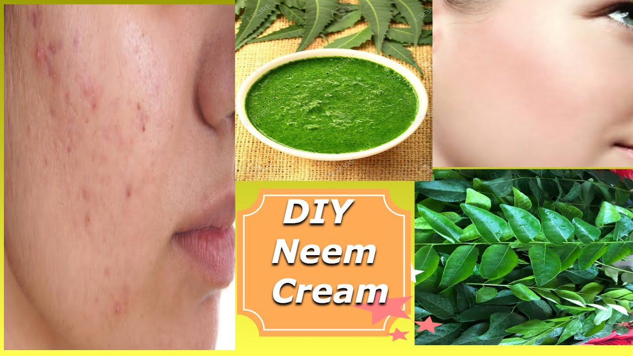 Homemade Neem Cream for Acne, Pimple & Dark spots with Only 3 ...